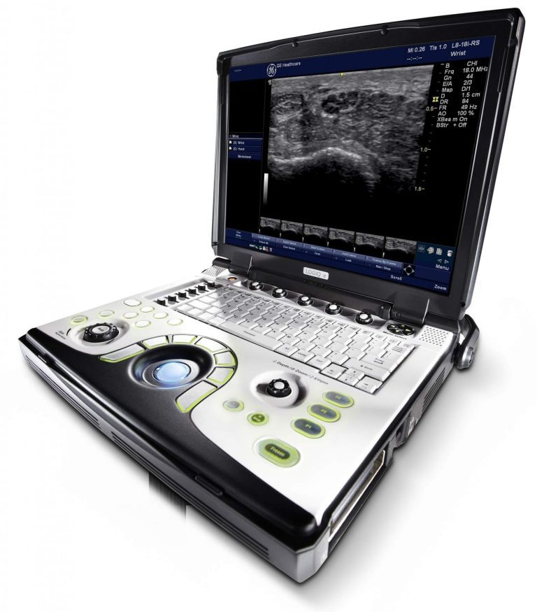 GE Logiq E Portable Ultrasound Machine | Vomark Technologies