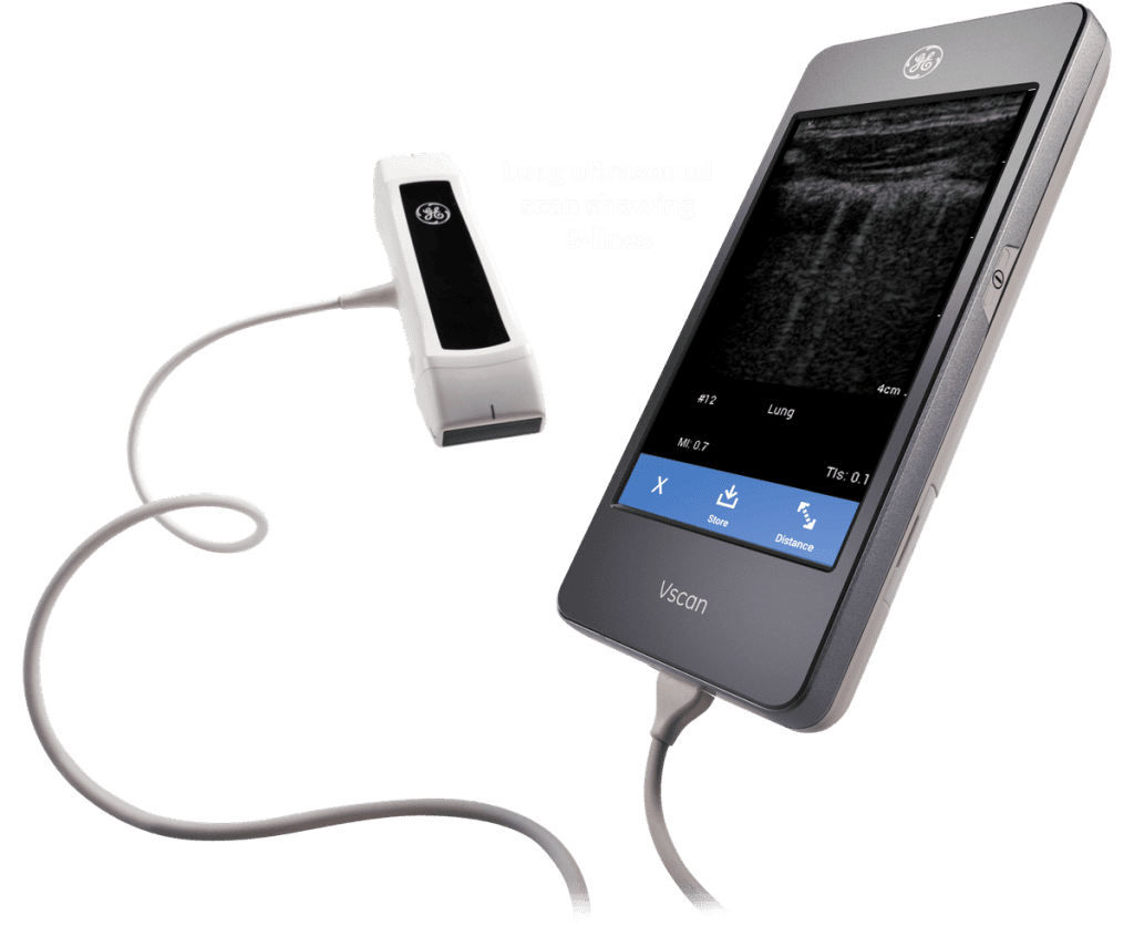 GE Vscan Ultrasound Machine | Vomark Technologies