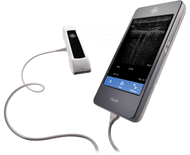 GE Vscan Ultrasound Machine | Vomark Technologies