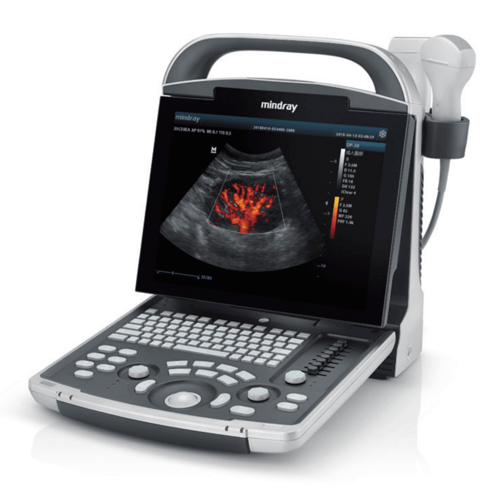Mindray DP-30 Portable Ultrasound Machine - Vomark Technologies