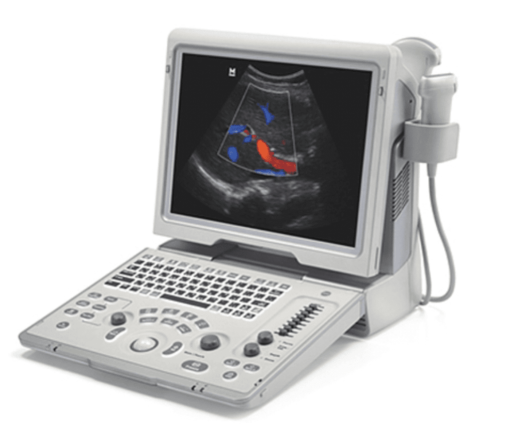 Mindray DP-50 Portable Ultrasound Machine - Vomark Technologies