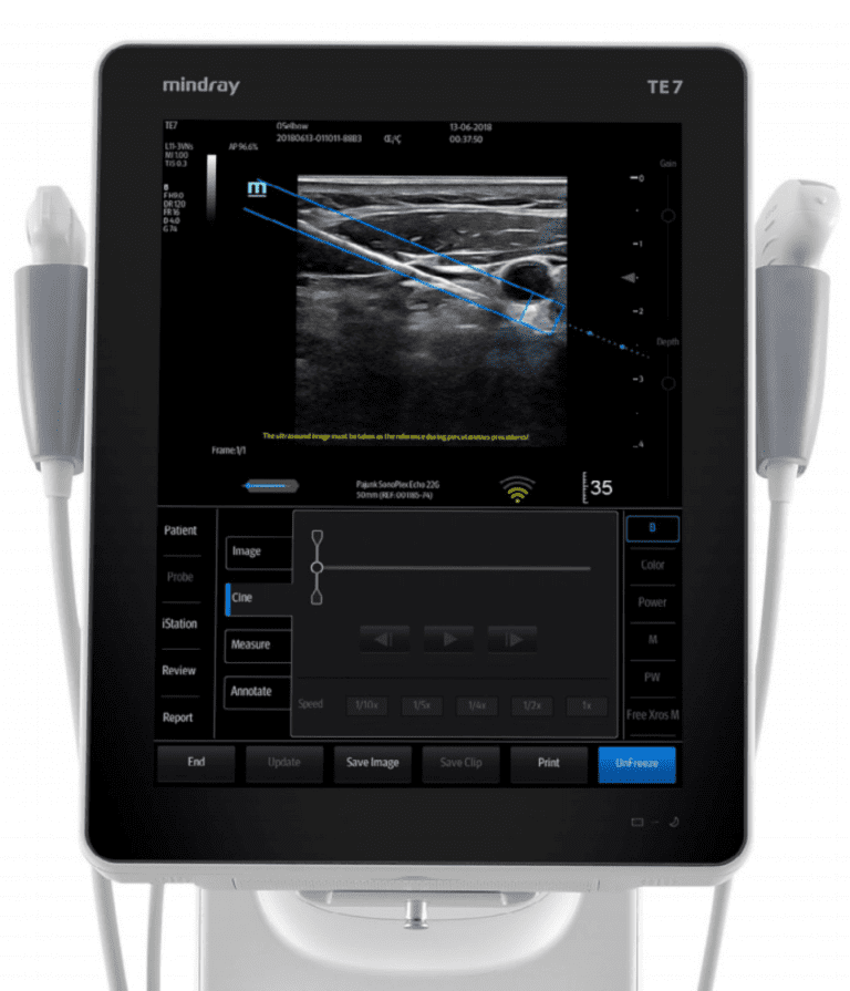 Mindray TE7 Portable Ultrasound Machine - Vomark Technologies