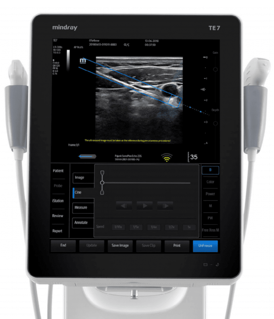 Mindray TE7 Portable Ultrasound Machine - Vomark Technologies