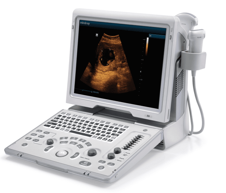 Mindray Z6 Portable Ultrasound Machine - Vomark Technologies