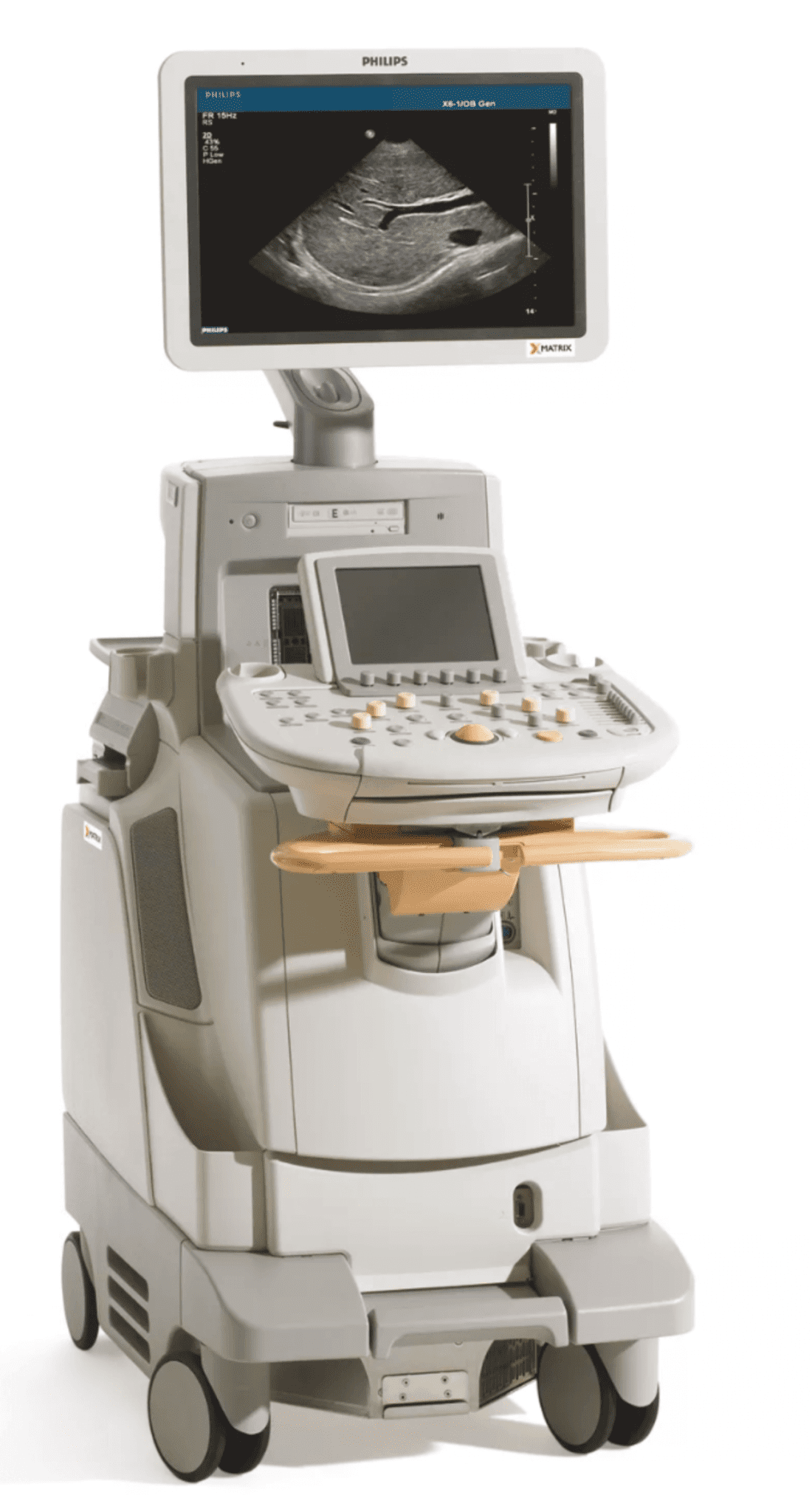 Philips iU22 Ultrasound Machine | Philips iU22