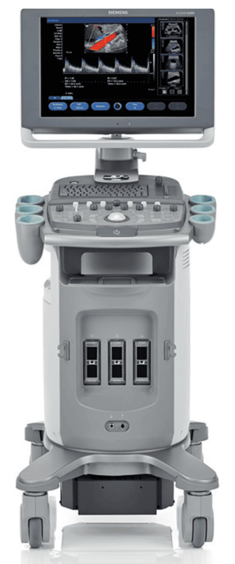 Siemens Ultrasound Machines | Siemens Ultrasound Systems