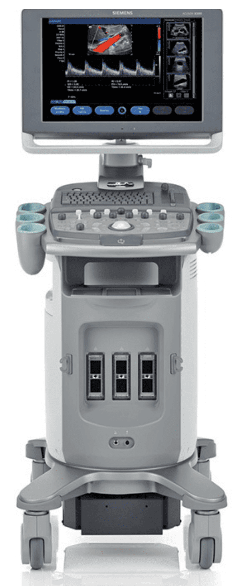 Siemens Ultrasound Machines | Siemens Ultrasound Systems