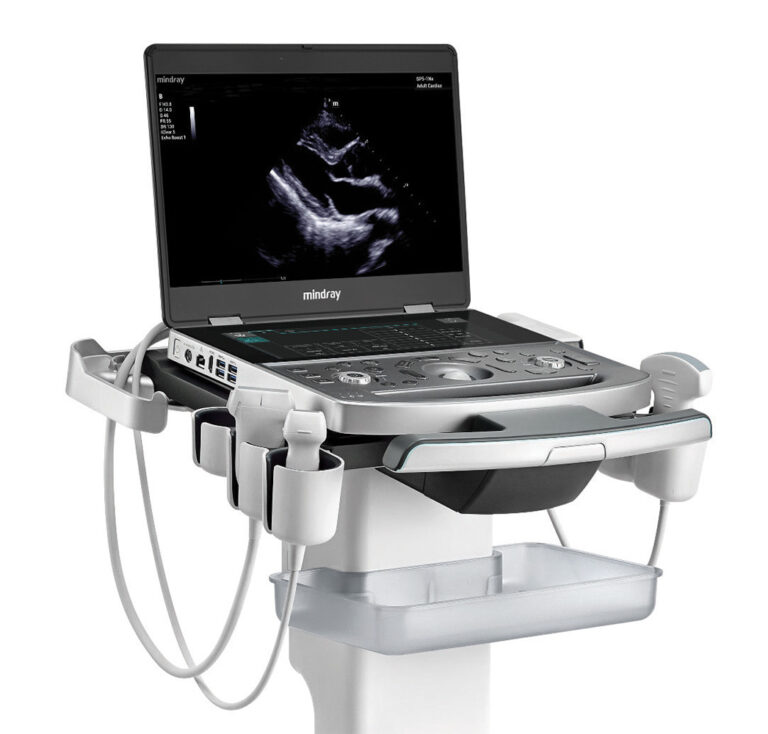 Mindray MX8 Portable Ultrasound Machine - Vomark Technologies