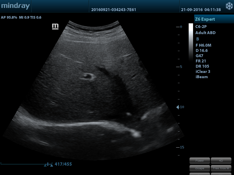 Mindray Z60 Portable Ultrasound Machine - Vomark Technologies