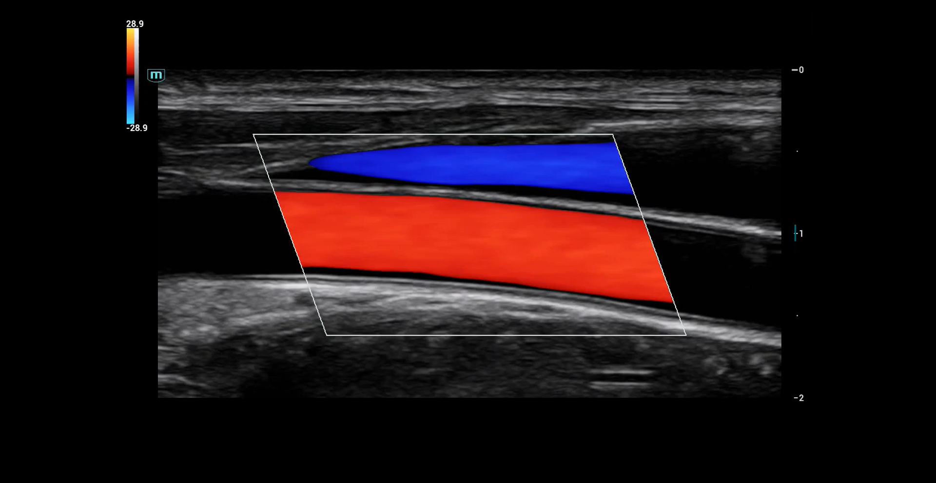 Mindray Consona N9 Ultrasound Machine | Mindray Consona N9