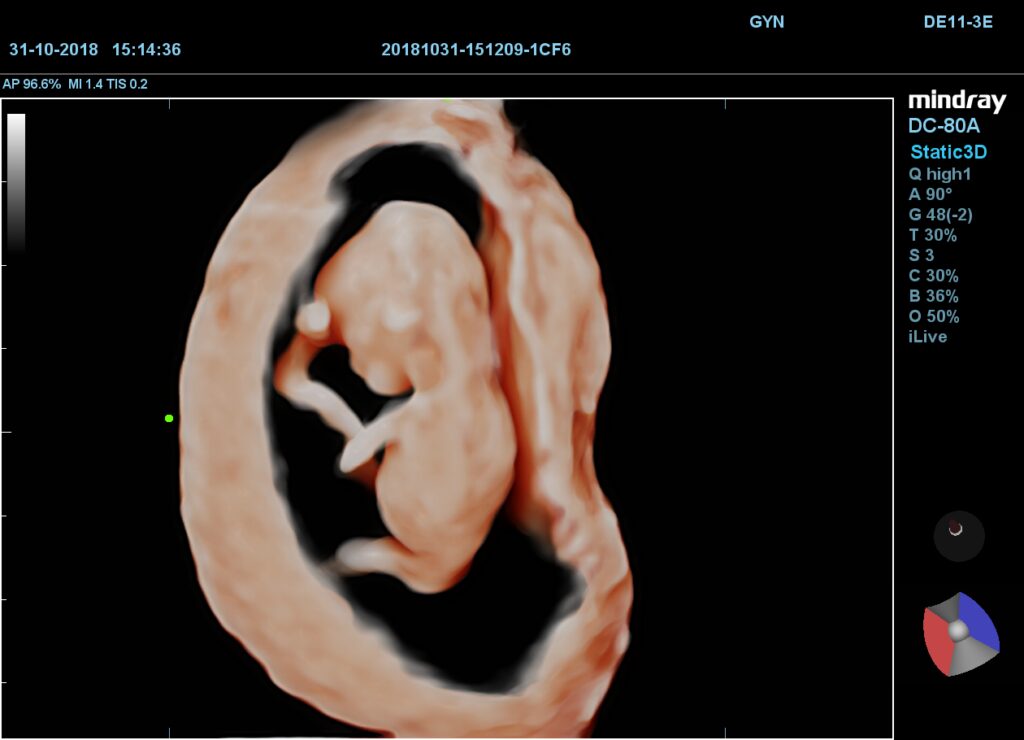 Mindray DC-88 Ultrasound Machine - Vomark Technologies