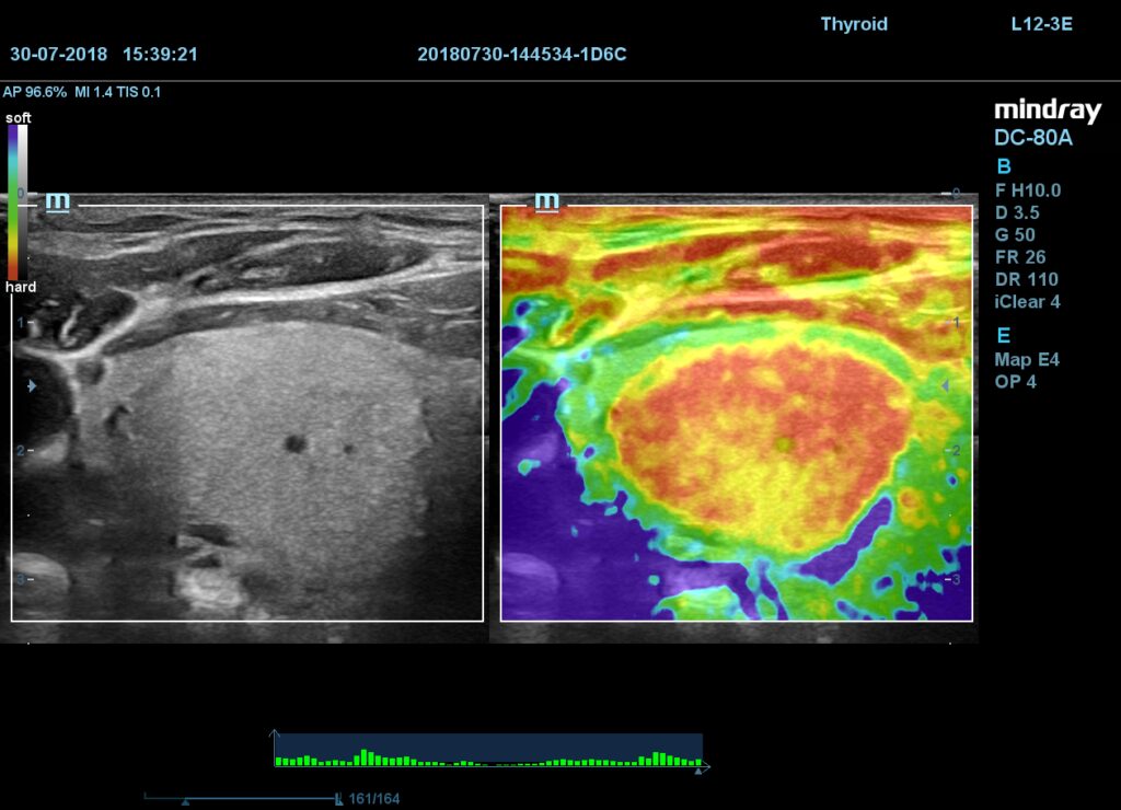 Mindray DC-88 Ultrasound Machine - Vomark Technologies