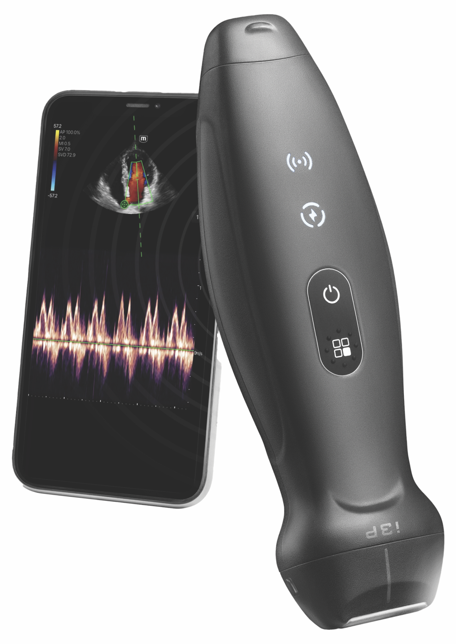 Mindray TE Air Wireless Handheld Ultrasound Machine - Vomark Technologies