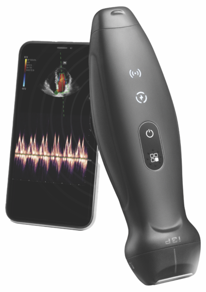 Mindray TE Air Wireless Handheld Ultrasound Machine - Vomark Technologies