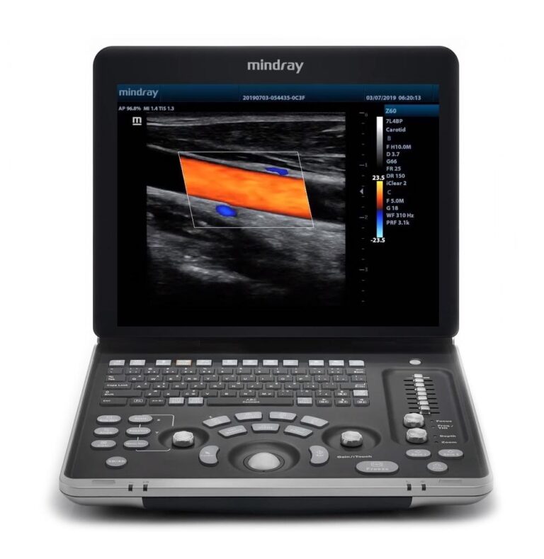 Mindray Z60 Portable Ultrasound Machine - Vomark Technologies