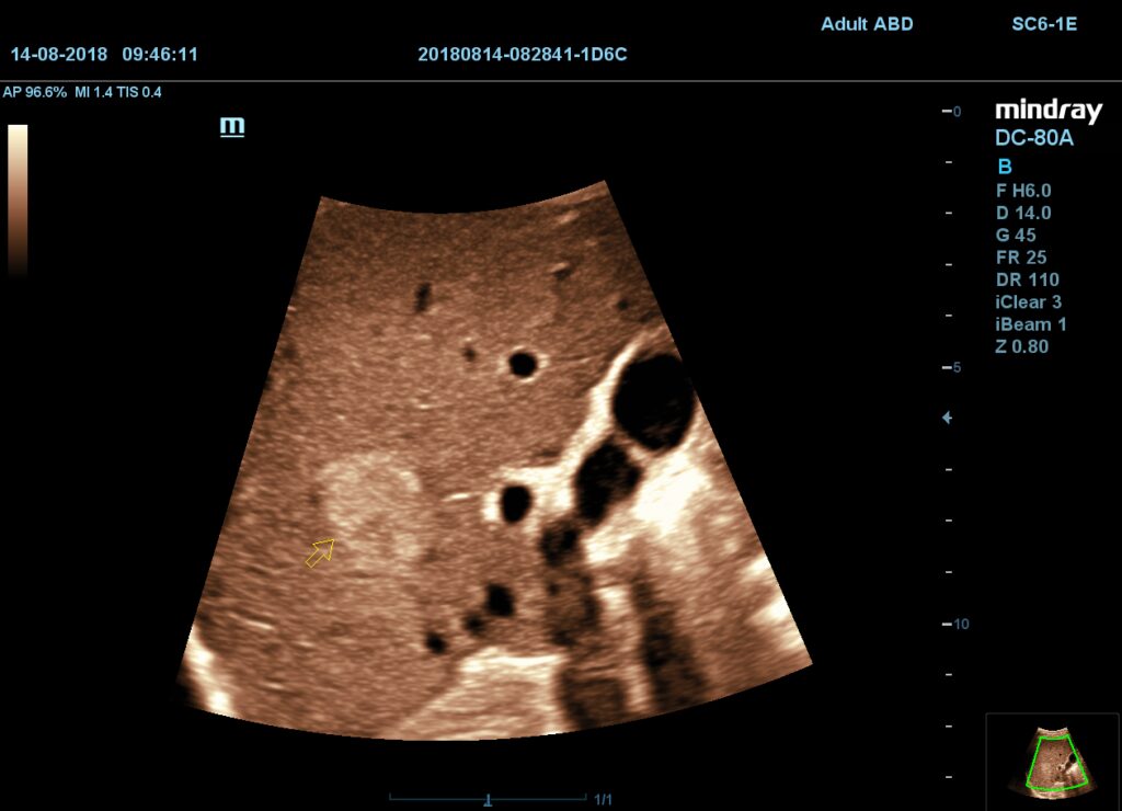 Mindray DC-88 Ultrasound Machine - Vomark Technologies