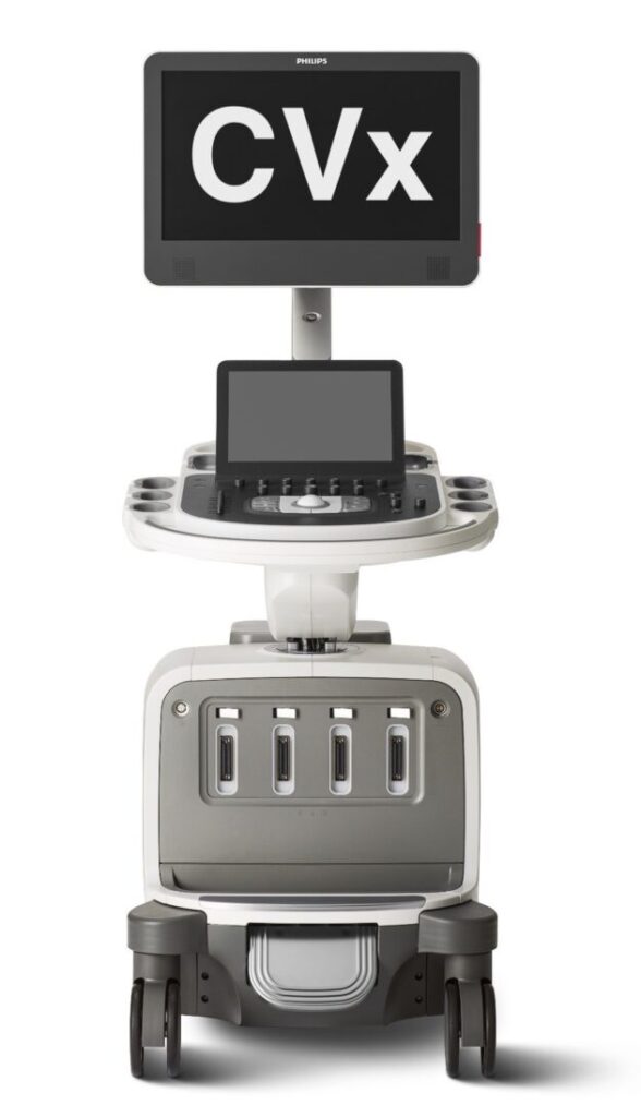 Philips EPIQ CVX Ultrasound Machine | Philips EPIQ CVX